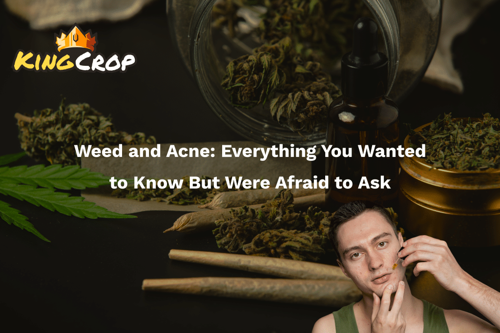 Does Smoking Weed Cause Acne? - KingCrop